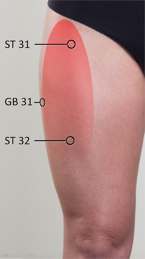 Lateral Femoral Cutaneous Nerve Applied Anatomy Lateral Femoral 