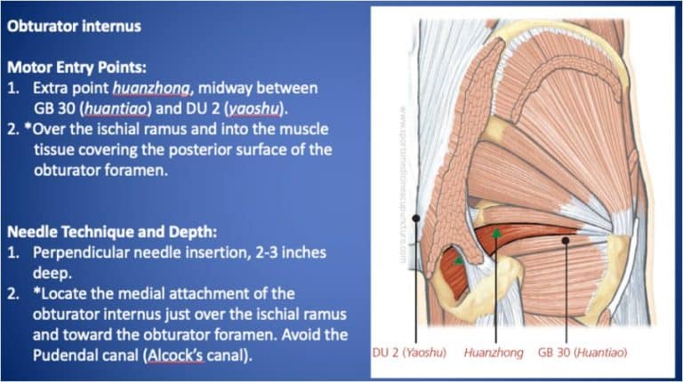 Obturator Internus: Muscle, Channel & Acupuncture Technique
